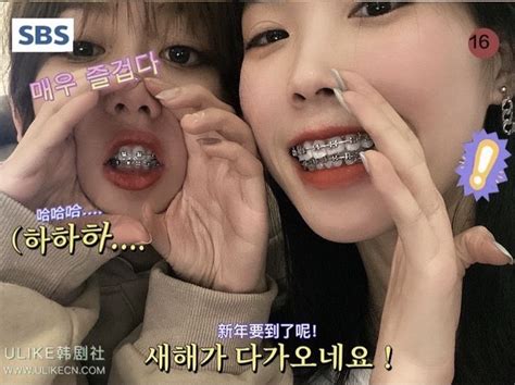 「orthodontic Appliances」おしゃれまとめの人気アイデア｜pinterest｜michael Bierbaum 矯正