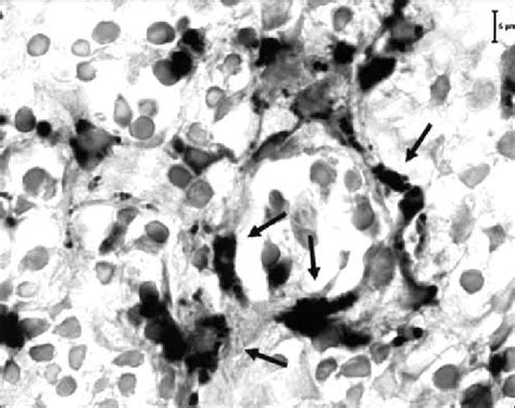 Reticular Tissue Lymph Node Lymph Node Reticular Fibres By Science