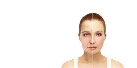 Deep Plane Facelift Vs Traditional Facelift Unveiling The Difference