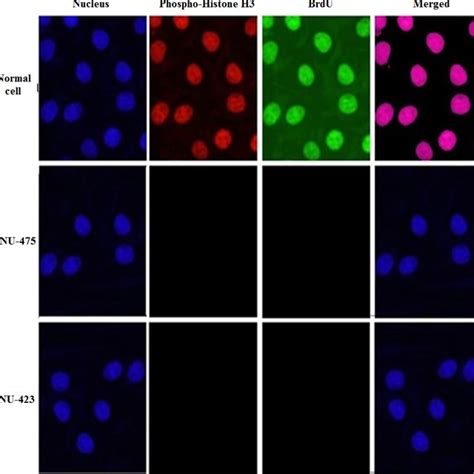 Aopi Double Staining Early Apoptotic Features Such As Chromatin