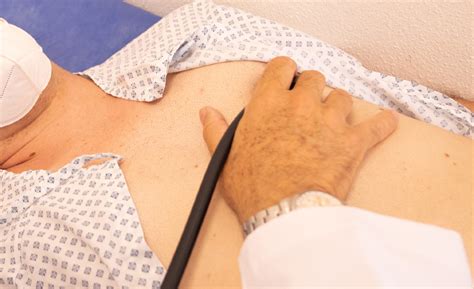 Advor Trial Cardiologia Negli Ospedali