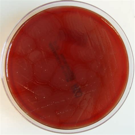 Proteus Spp 2