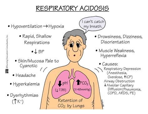 Respiratory Acidosis Anesthesia At Dolores Robertson Blog