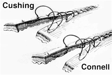 Suture Patterns Flashcards Quizlet