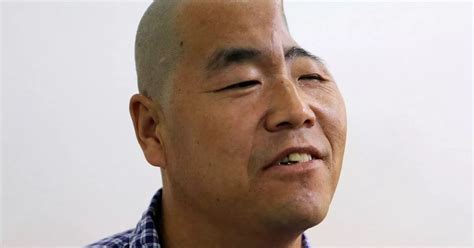 Man With Half A Skull Has Missing Part Replaced By 3d Prosthetic