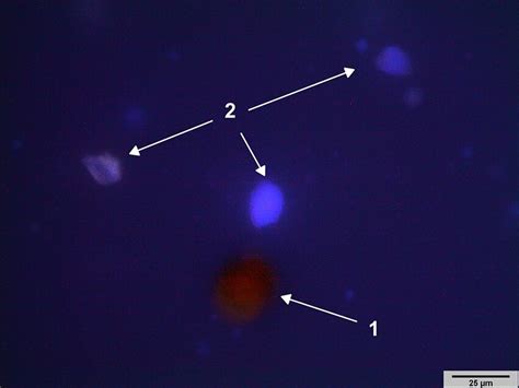 Micrograph ×200 Of Sample A Under Uv Light The Brown Particle 1 Is