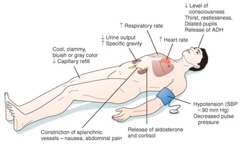 Shock Flashcards Quizlet Shock Flashcards Quizlet