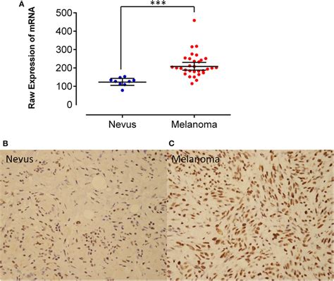 A By Analyzing The Affymetrix Expression Profile In The Geo Database