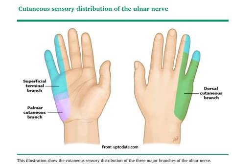 Ulnar Nerve Distribution Ulnar Nerve Anatomy Hand Clinics