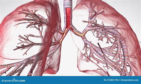 Chronic Bronchitis Is A Long Term Respiratory Condition That Affects The Bronchi And Bronchioles