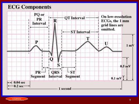 5 Parameters Of Ekg Interpretation1