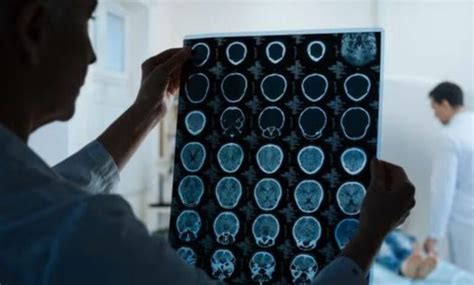 Testi I Parë I Gjakut Në Botë Për Tumorin E Trurit Rrit Shanset Për