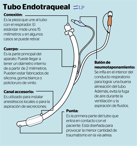 La Prensa Este Es El Tubo Endotraqueal Que Introducen Hasta La