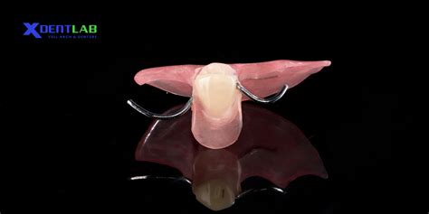 What Are The Different Types Of Removable Dentures