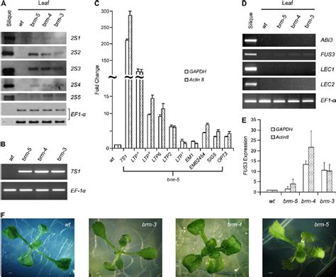 Validation Of The Dna Microarray Results A Rna Blot Analysis Of The Validation Of The Dna Microarray Results A Rna Blot Analysis Of The