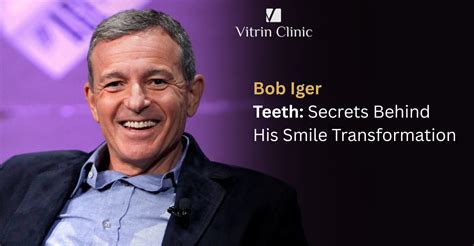 ¿quién Es Bob Iger Y Por Qué Se Nota Su Sonrisa Vitrin Clinic