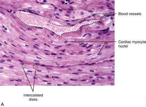 Cardiac Muscle Clinical Tree