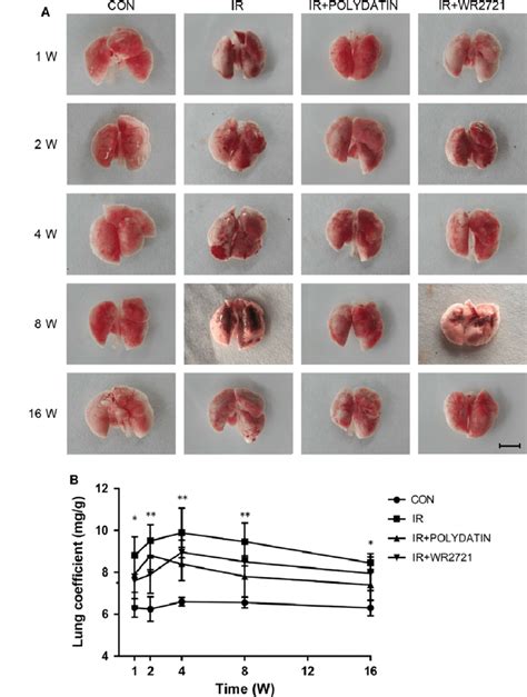 Polydatin Reduced Radiation Caused Hyperaemia Oedema In Pulmonary