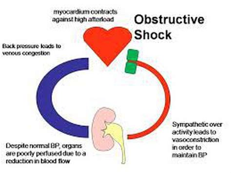 Causes Of Obstructive Shock Medizzy