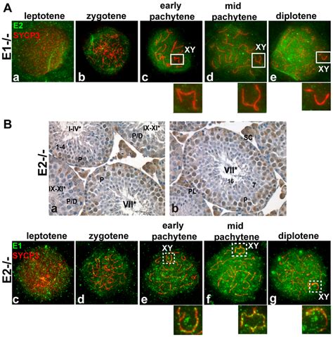 E1 Levels And Temporal Pattern Of Expression Are Significantly Altered