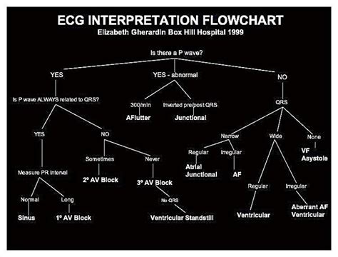 EKG Interpretation Nurse Ekg Interpretation Cardiac Nursing