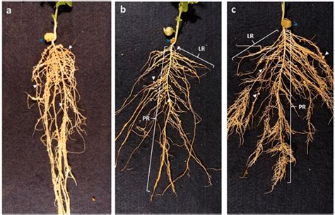 The Root Phenotypes Of The Different Pea Lines Inoculated With