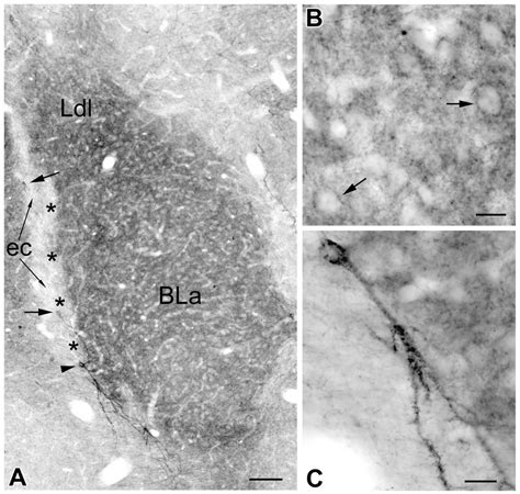 A Higher Power Photomicrograph Of The Portion Of The Basolateral