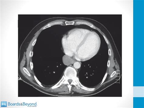 Pdf Pulmonary Embryology Dokumen Tips
