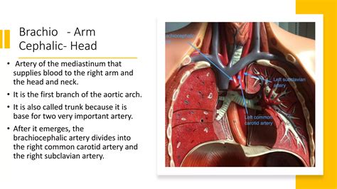 Brachiocephalic Artery Pptx