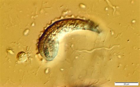Termite Symbiotic Protists And Prokaryotes Stage One Study Protists