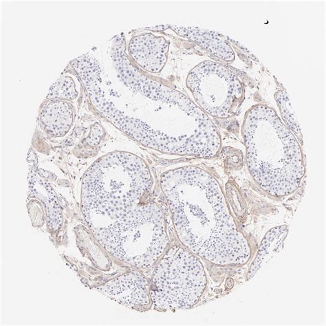 The Molecular Signature Of Human Testicular Peritubular Cells Revealed