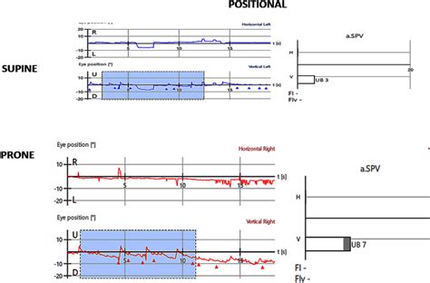 Effect Of Supine And Prone Positions November 2022 Download Scientific Diagram
