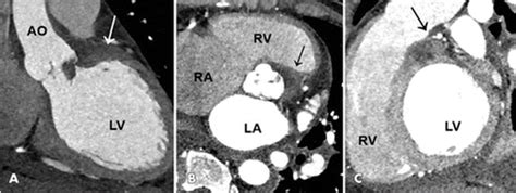 Cardiovascular Ct And Mri In 2020 Review Of Key Articles Radiology