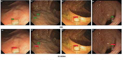 Figure 10 From A Multiscale Polyp Detection Approach For Gi Tract Images Based On Improved
