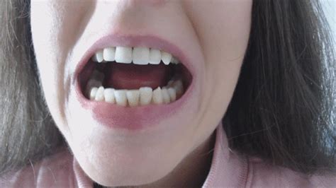 Intense Teeth Check Up Fetishgoddess Clips4sale