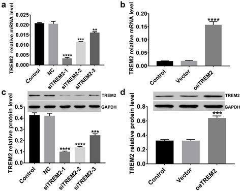Effect Of Trem2 On Release Of Inflammatory Factor From Lps Stimulated Microglia And Its Possible