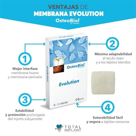 Total La Estructura De Membrana Evolution Está Hecha De Densas Fibras