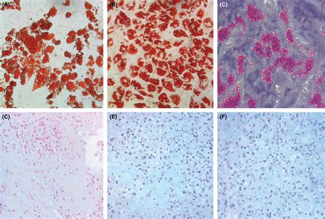 Differentiation Of Representative Cell Lines Into Adipocyte And