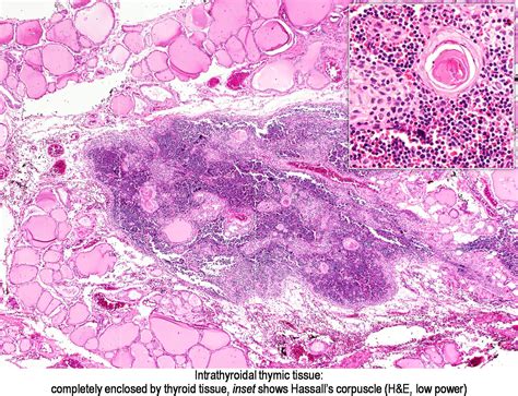 Thymus Histology Thymus Histology