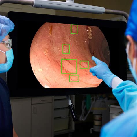 Ai Endoscopy Module Imedex Technology Scout