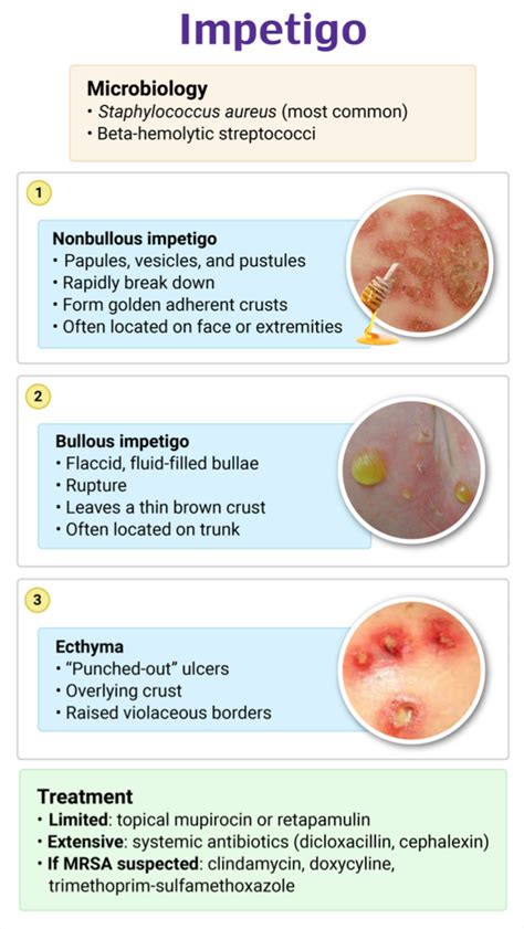 Em3am Impetigo Emdocs