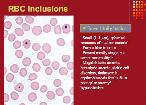 Pappenheimer Bodies Vs Basophilic Stippling