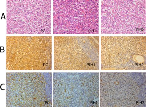 The Histology Of Placenta The Immunohistochemical Staining For Cd31