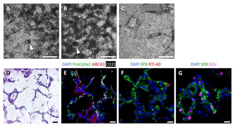 Engineered Lung Tissues Prepared From Decellularized Lung Slices