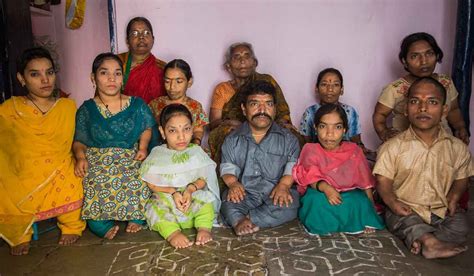 Are You Known About Achondroplasia Health