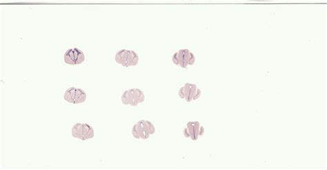 Nectin3 Rna In Situ Gene Expression Assay Gxd