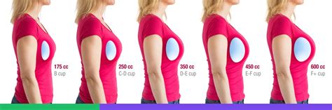 Safest Breast Implants 2024 Things To Consider Before Getting Breast