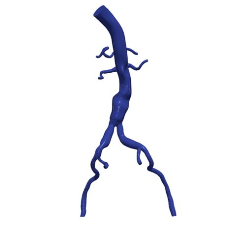 3d Model Aorta 3d Print Model Mito3d