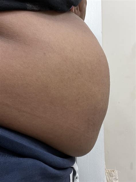 First Coke And Mentos Bloat R Bellyinflating