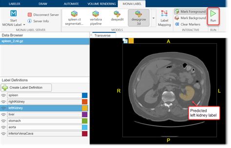 Get Started With Monai Label In Medical Image Labeler Matlab And Simulink